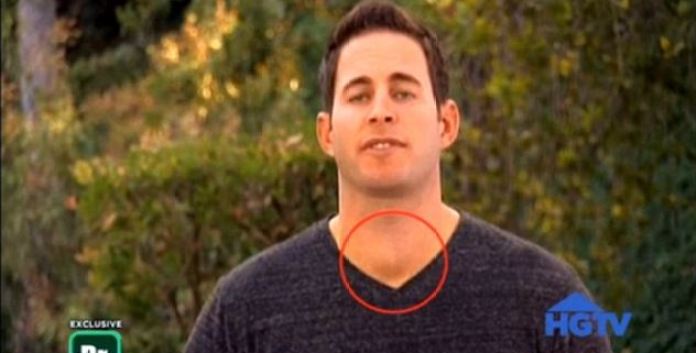 Tarek El Moussa shared a heartbreaking update about his fight against ...